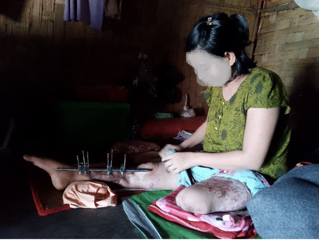 I don't have a single kyat. I'm worried about what to do. Sometimes when the wound hurts. I'm ...